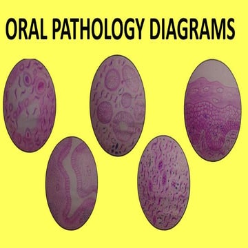 Oral pathology diagrams - Histopathological slides of pathologies of ...