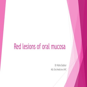 Red lesions of oral mucosa.pdf. lecture oral medicine | PDF