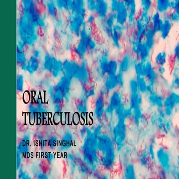 Oral Tuberculosis Ppt