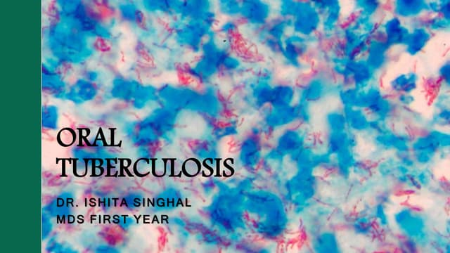 Oral Tuberculosis Ppt