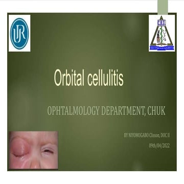 orbital cellulitis.pptx