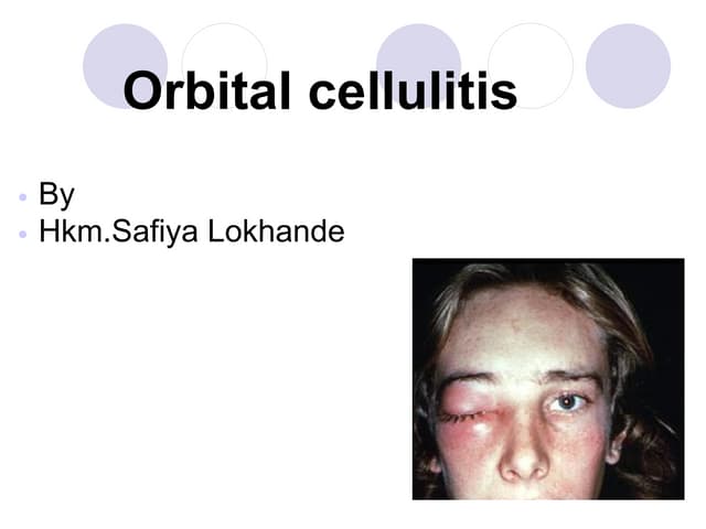 orbital cellulitis.pptx