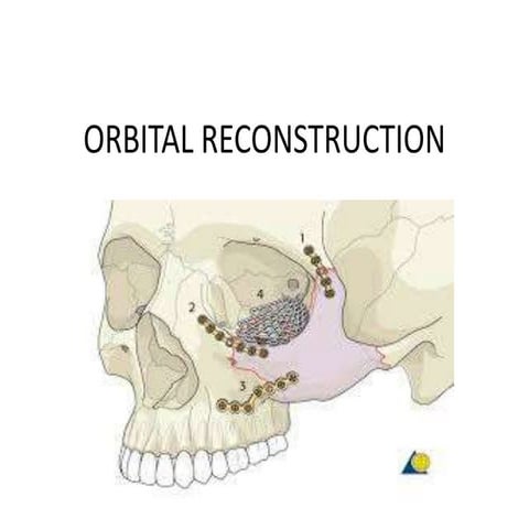 Orbital reconstruction | PPT