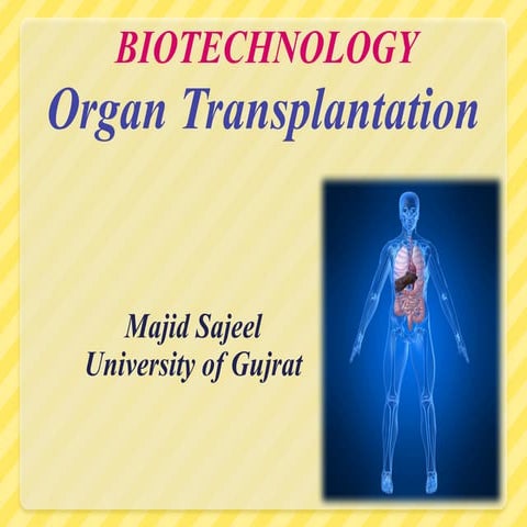organ -transplantation medical procedure | PPTX