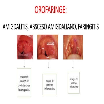 tema: otorrinonaringología - orofaringe. | PPTX