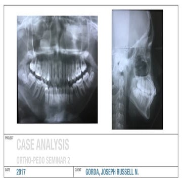 Orthodontics Case Analysis | PDF