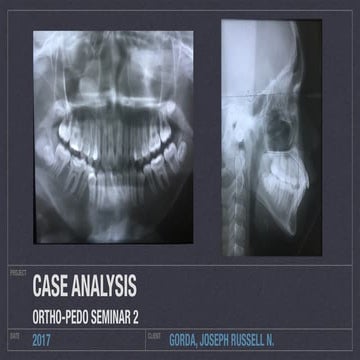 Orthodontics Case Presentation | PDF