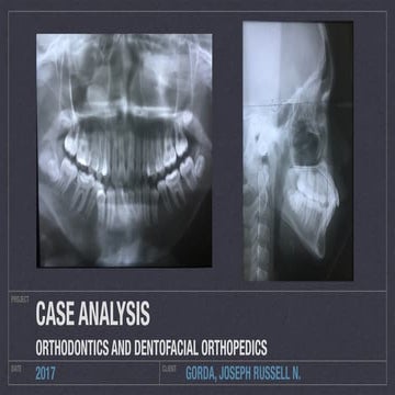 Orthodontics and Dentofacial Orthopedics Case Analysis | PDF