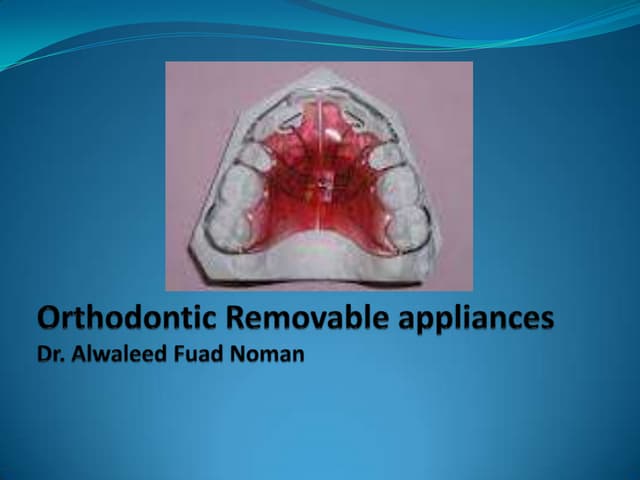 clasps in removable orthodontic appliance | PPTX