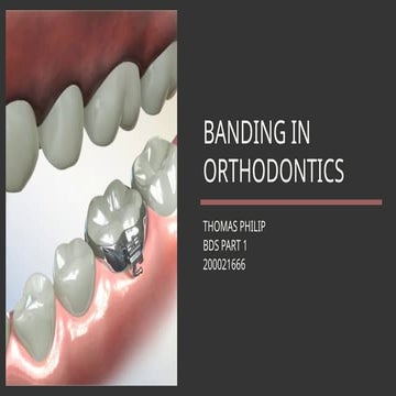 BANDING AND BONDING INN ORTHODONTICS | PPT