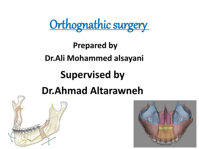 Envelope of Discrepancy in Orthodontics: Enhancing Precision in ...