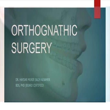Orthognathic Surgery Ppt VSP Orthognathics
