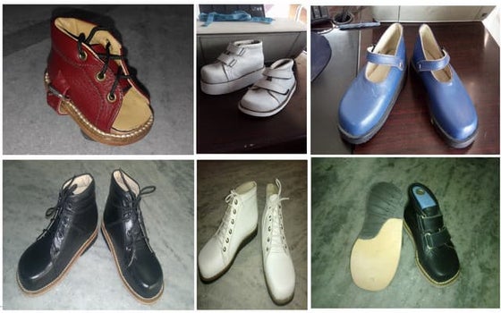Caliper shoes for polio patients @ My Care Prosthetics and Orthotics | PDF