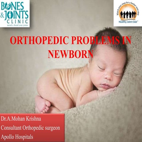 Orthopedic problems in newborn | PPTX