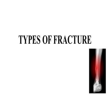 Orthopedics - All Types of Fractures.pdf