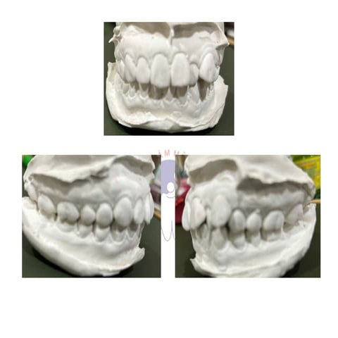 Ortho patient record to get treatment plan.pptx