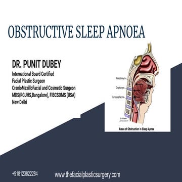 OBSTRUCTIVE SLEEP APNOEA TREATMENT | PDF