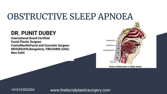 Obstructive sleep apnea- Orthodontist's perspective | PPTX | Ear, Nose ...