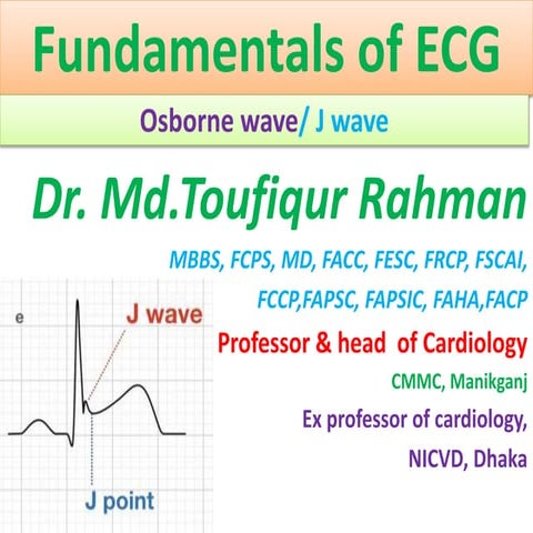 Osborne wave(J wave) and j point in ECG | PPSX | Heart and ...
