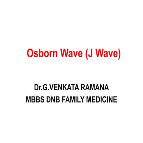 OSBORN WAVE (J Wave) IN ECG AND ITS INTERPRETATION | PPT