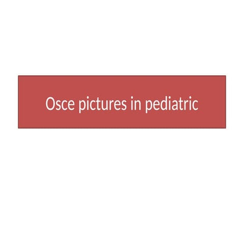 OSCE 2 detailed evaluation. Check this out | PPTX