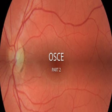 DNB Practical Opthalmology OSCE Questions 1 | PPTX