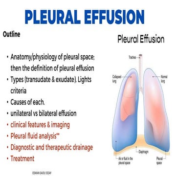 OSS -PLEURAL EFFUSION - BY OSMAN.pptx