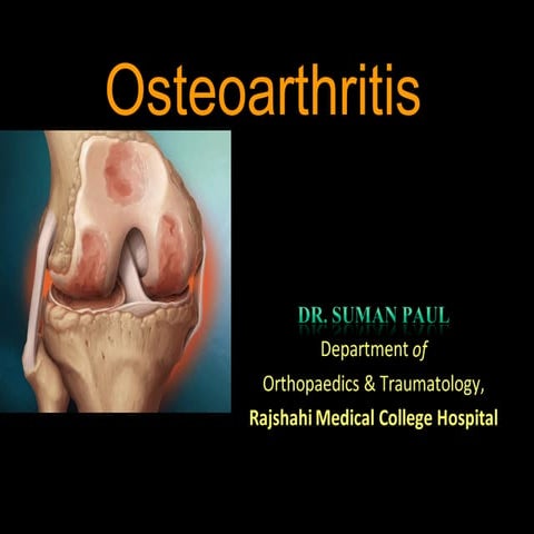 Osteoarthritis | PPT