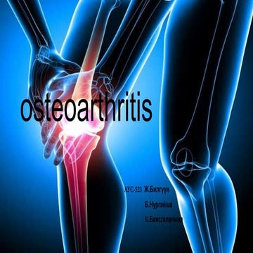 Osteoarthritis | PPTX