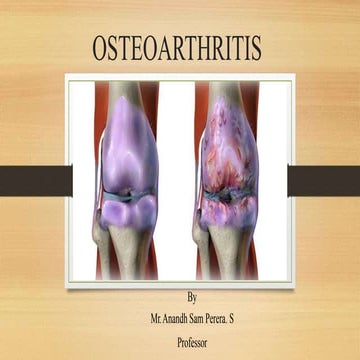 Osteoarthritis | PPT