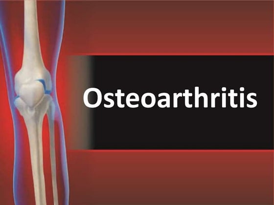 Osteoarthritis | PPT
