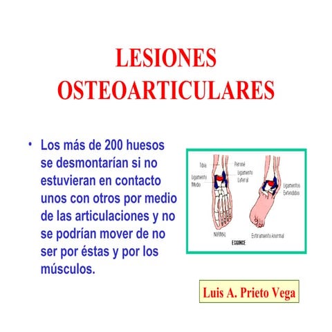 Osteoarticular | PPT