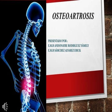Osteoartrosis | PPTX