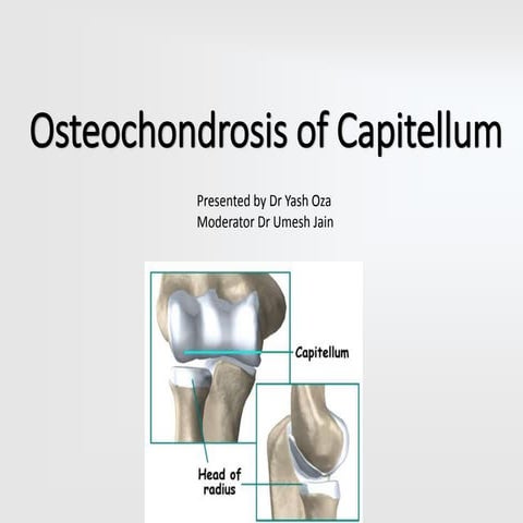 Osteochondrosis of capitellum | PPTX
