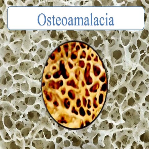 Osteomyelitis, osteomalacia,osteoprosis, bne tumor | PPTX