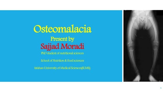 Osteomalacia | PPT