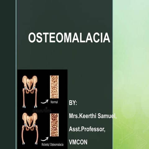 Osteomalacia 2nd-150704155942-lva1-app6892 [autosaved] | PPTX