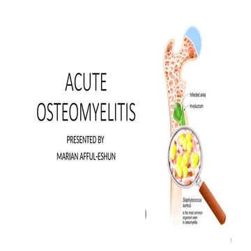 Aetiology, pathology and management of osteomyelitis | PPTX