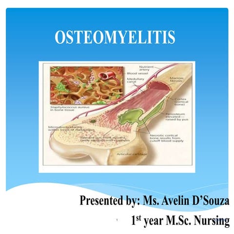 Osteomyelitis.university.presentation.pptx