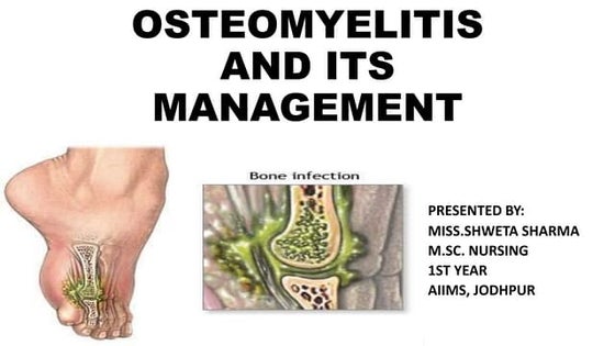 Osteomyelitis | PPT