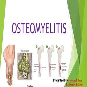 OSTEOMYELITIS PPT or SLIDE SHARE it is a bone disease | PPTX