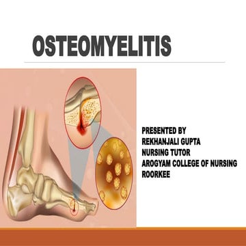 OSTEOMYELITIS PPT PRESENTATION BY REKHANJALI GUPTA | PPT