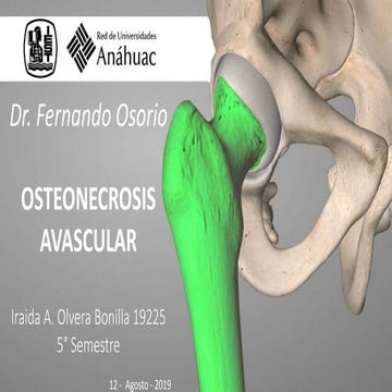Osteonecrosis de cabeza femoral | PPTX
