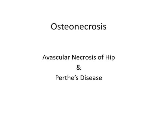 Avascular necrosis of hip joint | PPTX