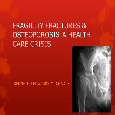 Osteoporosis Community Talk Ppt