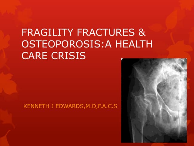 Osteoporosis Community Talk Ppt