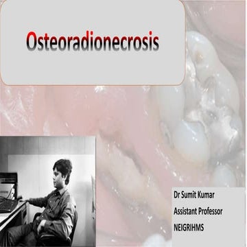 OSTEORADIONECROSIS.pptx
