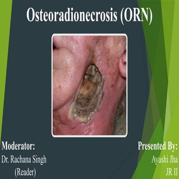 OSTEORADIONECROSIS of the jaw, osteonecrosis of the jaw | PPTX