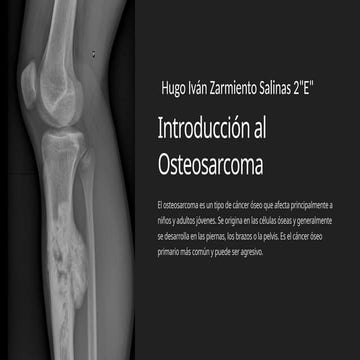 Osteosarcoma- presentación de anatomía patológica.pptx