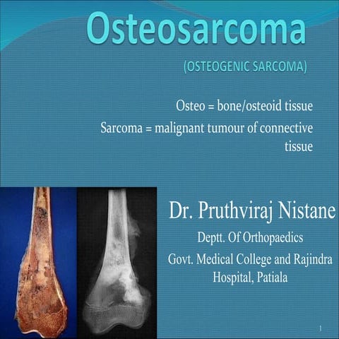 Osteosarcoma (1) | PPT